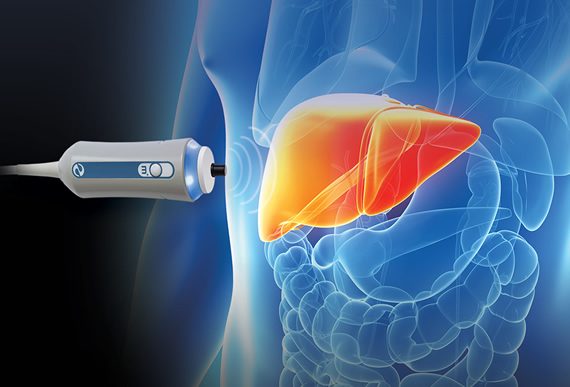 FibroScan® - Gastroenterology Consultants of San Antonio