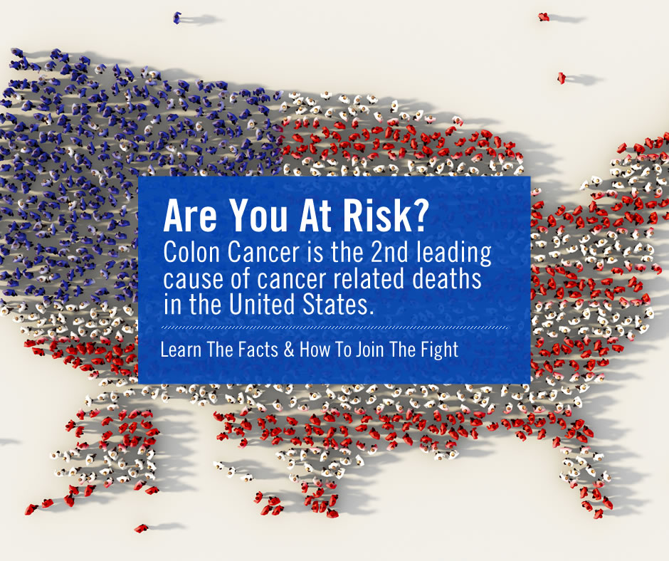 Colon Cancer 2nd Leading Cause of Cancer Deaths | Colon Cancer Facts