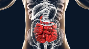 Where Is Your Colon?